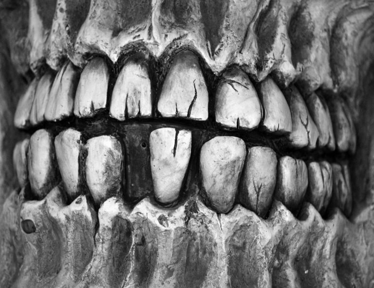 skeleton-skull-teeth - Longmeadow Family Dental Care