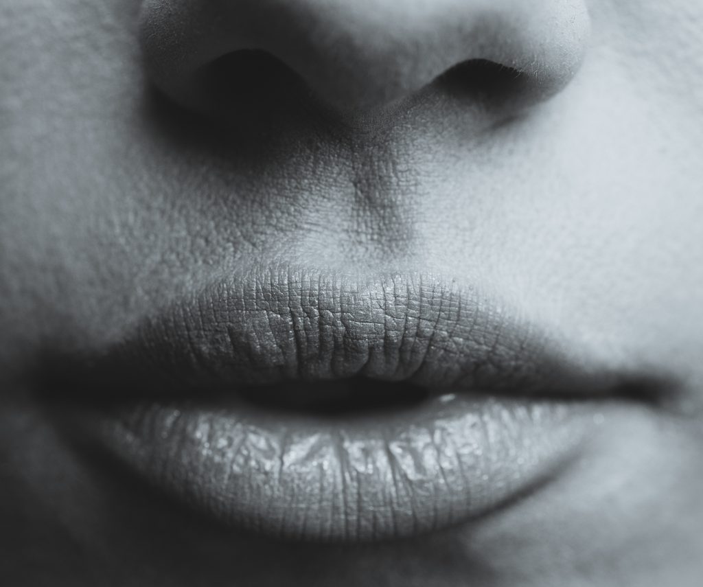 Protect Your Lips this Winter - Longmeadow Family Dental